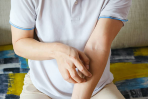 Anxiety Rash, Symptoms, Causes, and Treatments